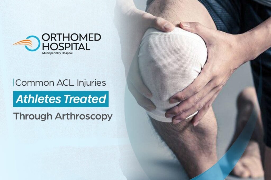 Common ACL Injuries in Athletes Treated Through Arthroscopy ...