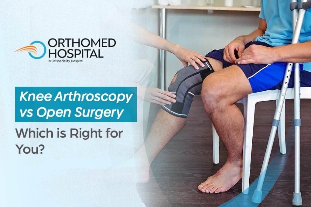 Knee Arthroscopy vs. Open Surgery: Which Is Right for You ...